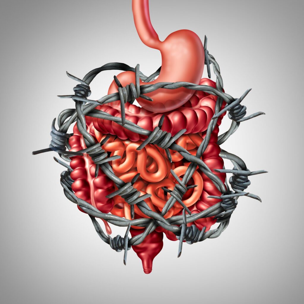 The Link Between Lymphatic Health and Irritable Bowel Syndrome - Body ...